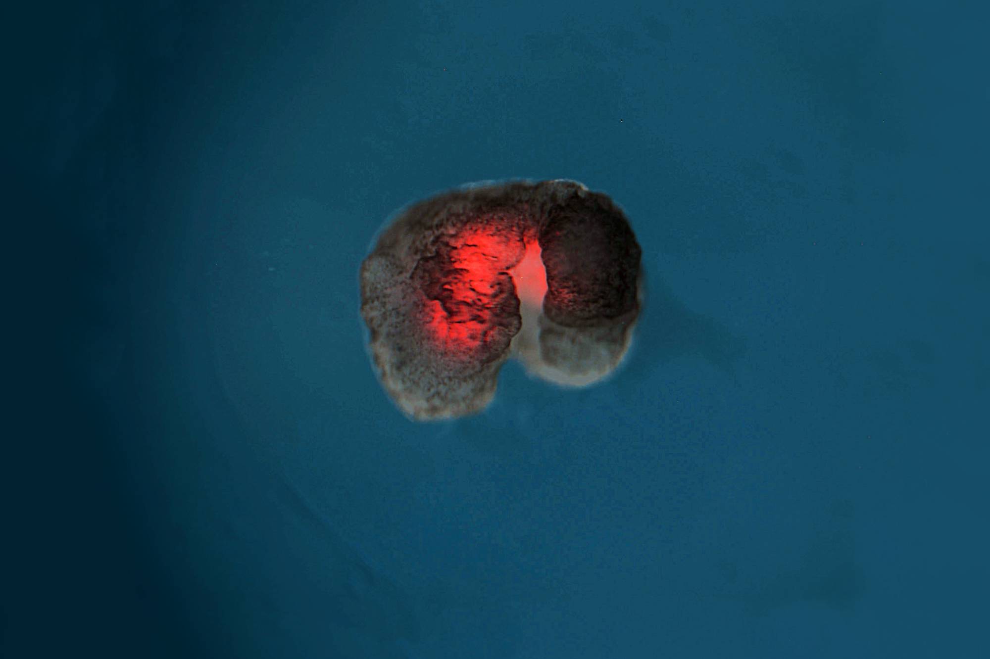 Xénobot : le robot vivant