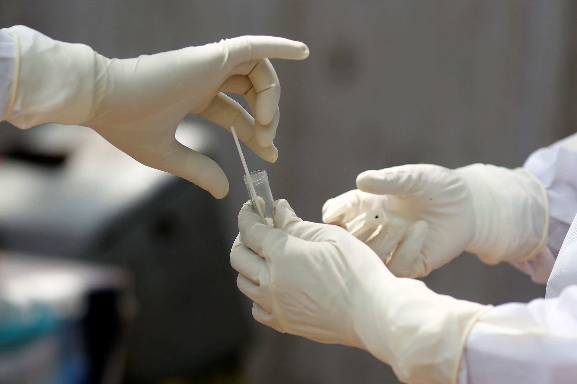 Coronavirus : une personne infectée sur cinq ne présente pas de symptôme