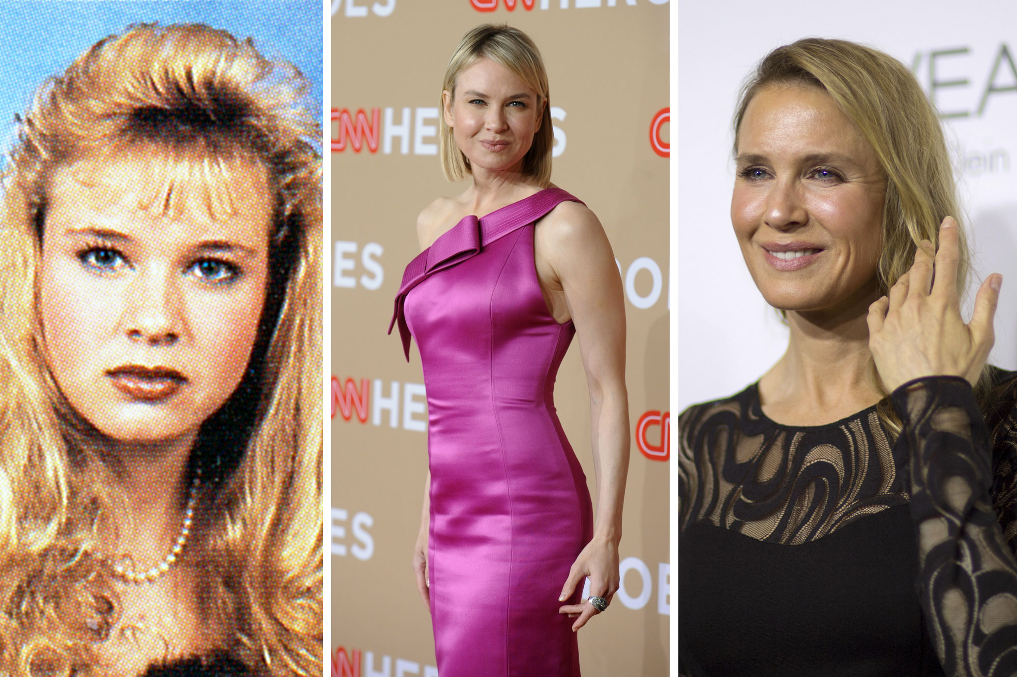 Les transformations physiques de Renee Zellweger